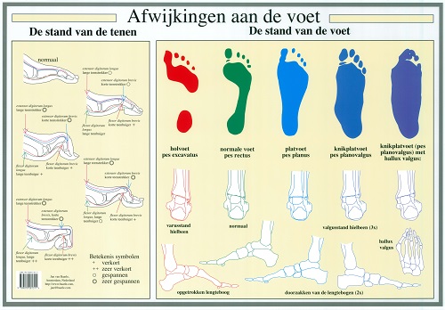 Anatomieposter / anatomische poster - Voet en voetafwijkingen poster ...